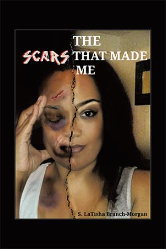 Healing Thru U | The Scars That Made Me Book